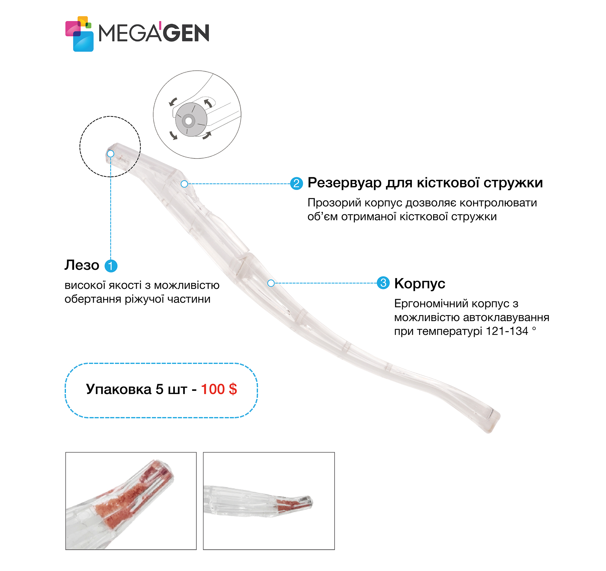 MegaGen - Лідер серед зубних імплантатів
