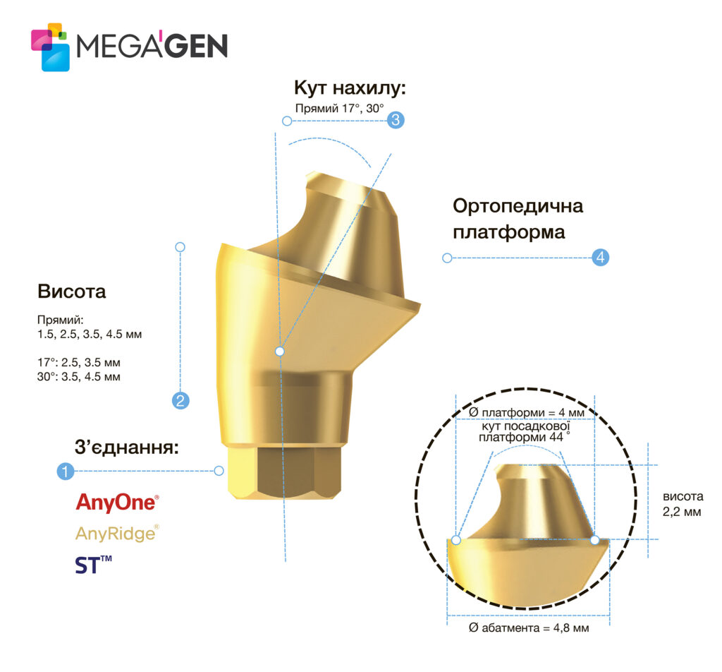 MegaGen - Лідер серед зубних імплантатів