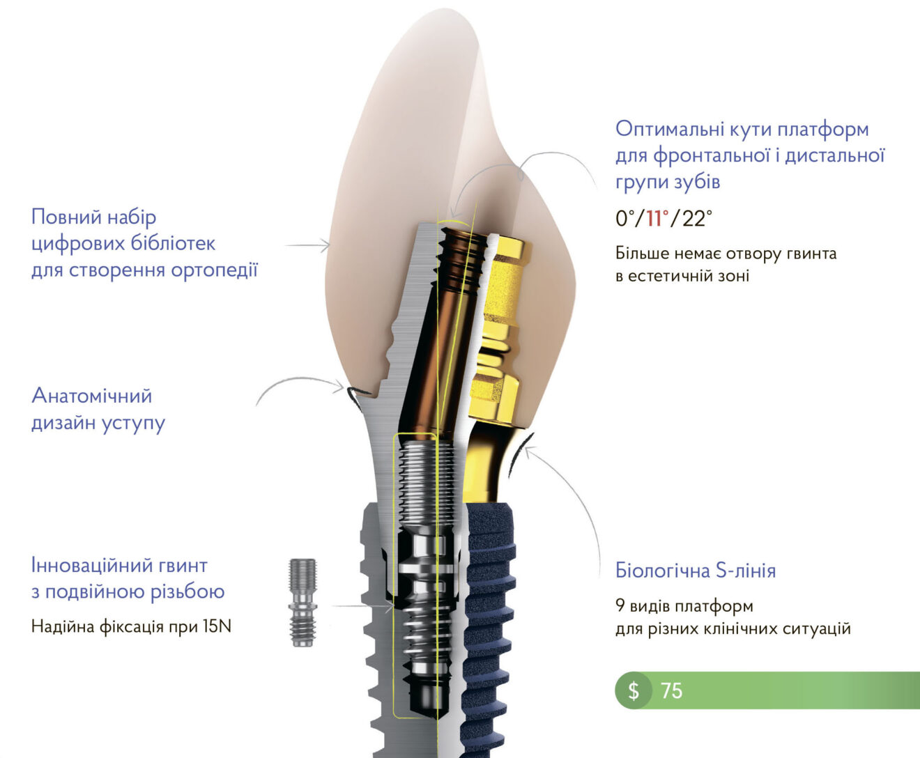 MegaGen - Лідер серед зубних імплантатів